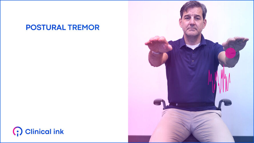 Mobile Postural Tremor Assessment | Clinical ink